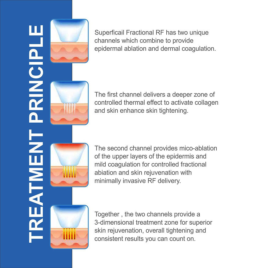 Fractional RF Micro Needle Machine | Advanced Skin Rejuvenation – COSDERMA